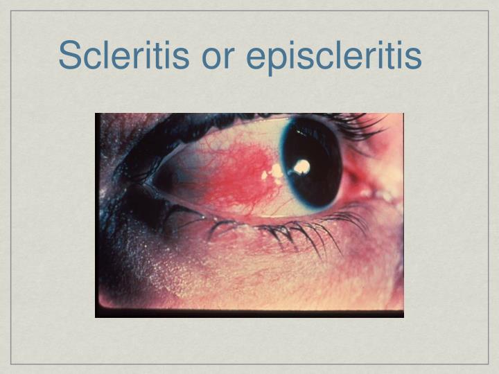 PPT - Essentials of Ophthalmology PowerPoint Presentation - ID:22855