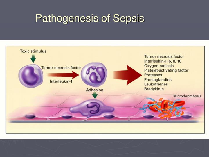 PPT - Sepsis : Pathophysiology and Treatment PowerPoint Presentation ...