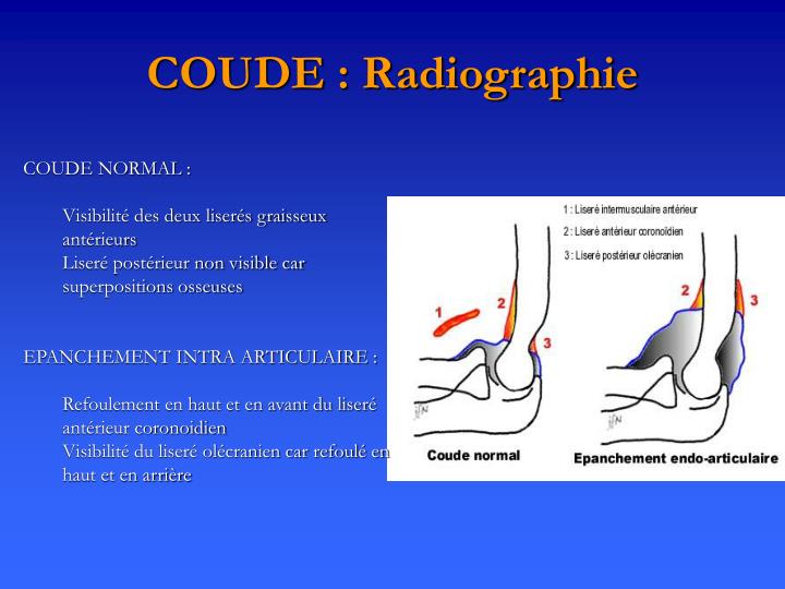 PPT - ANATOMIE RADIOLOGIQUE DU COUDE PowerPoint Presentation - ID:231059