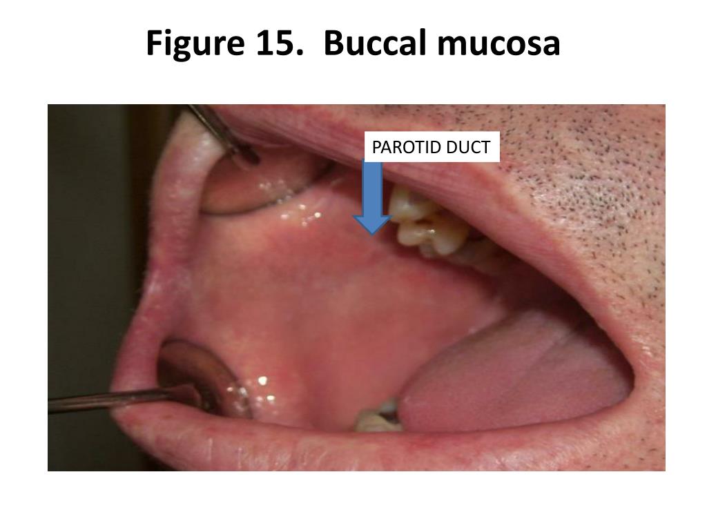 PPT - Oral and neck examination for the early detection of oral (mouth ...