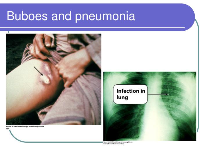 PPT - Enterobacteriaceae PowerPoint Presentation - ID:231956