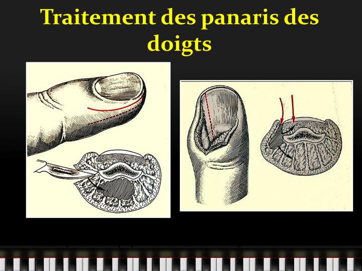PPT - Dossier 10 PowerPoint Presentation - ID:235080