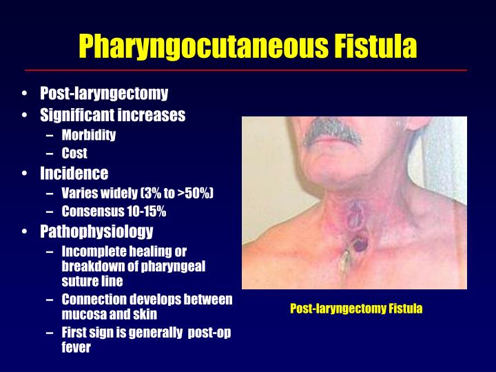 PPT - Hyperbaric Oxygen in ORL-HNS: Facts, Fictions, and Evidence ...
