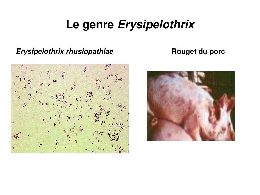 PPT - LES BACILLES GRAM POSITIFS CULTIVANT EN ATMOSPHERE AEROBIE ...