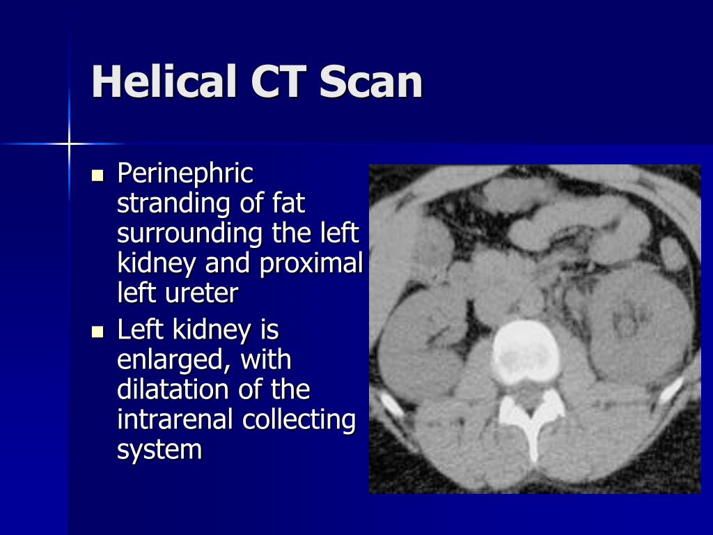 Ppt Ob Gyn And Male Gu Powerpoint Presentation Free Download Id 238344
