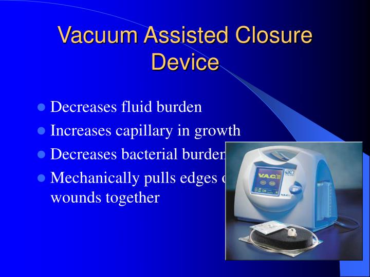 PPT - Best Practices in Community Wound Care PowerPoint Presentation ...