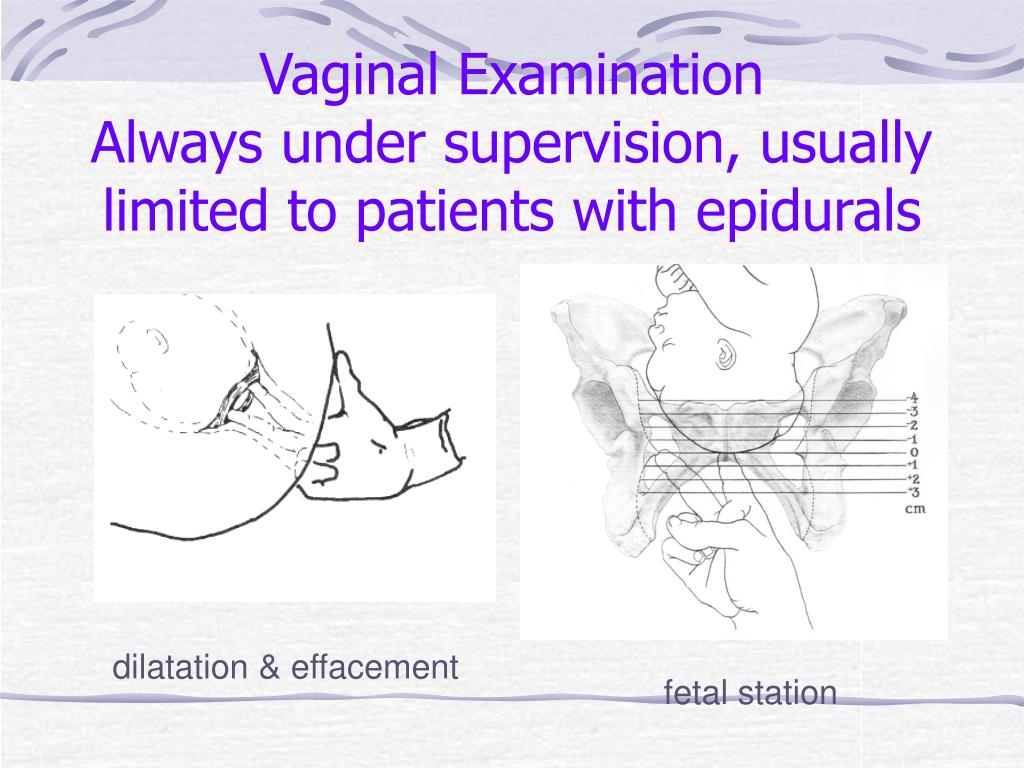 Ppt Welcome To Ob Gyn Powerpoint Presentation Free Download Id 24062