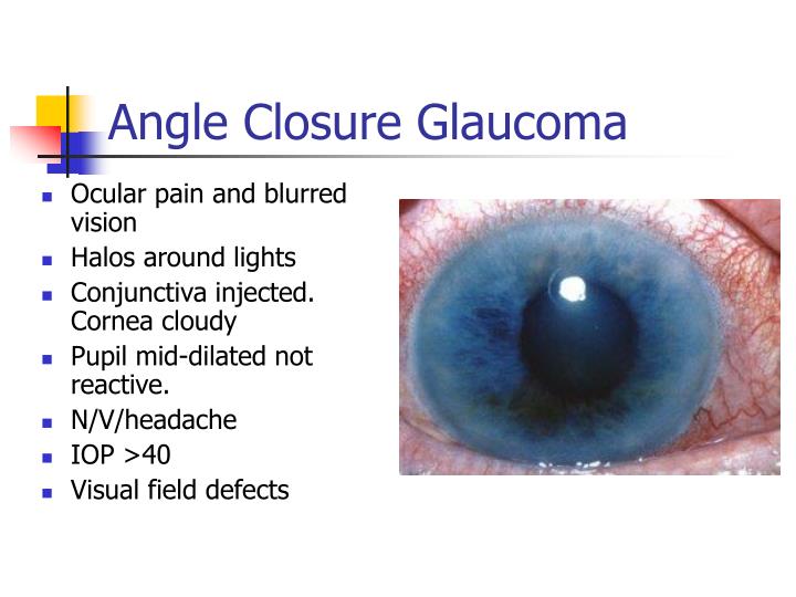 PPT - The Differential Diagnosis of The Red Eye PowerPoint Presentation ...