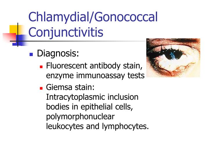 PPT - The Differential Diagnosis of The Red Eye PowerPoint Presentation ...
