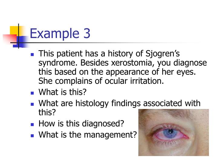 PPT - The Differential Diagnosis of The Red Eye PowerPoint Presentation ...