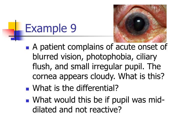 PPT - The Differential Diagnosis of The Red Eye PowerPoint Presentation ...