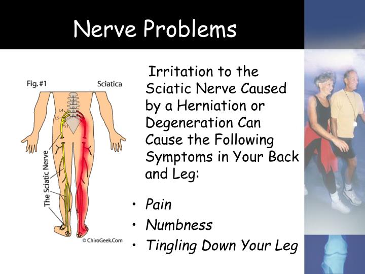 PPT - Introducing ….. Spinal Decompression Therapy PowerPoint ...