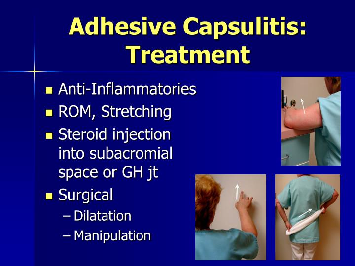 PPT - COMMON SHOULDER PROBLEMS PowerPoint Presentation - ID:245881