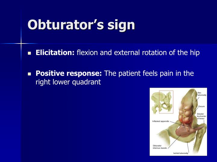 PPT - Acute Abdomen PowerPoint Presentation - ID:246449