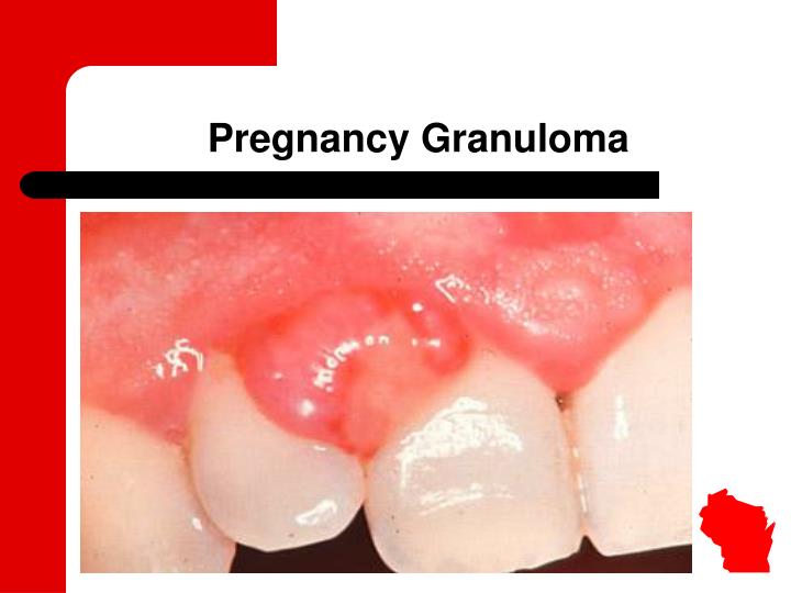 PPT - Integrating Preventive Oral Health Measures Into HealthCare ...