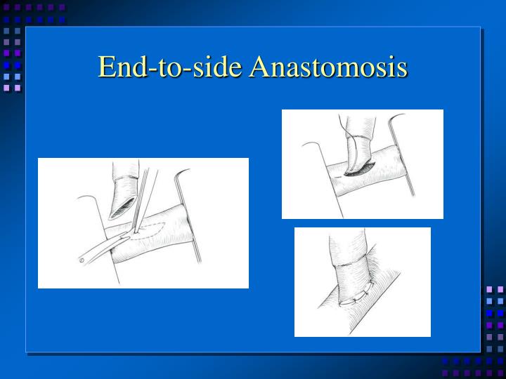 PPT - Microvascular Free Tissue Transfer PowerPoint Presentation - ID ...