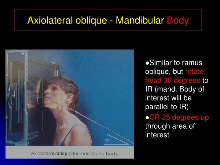 PPT - The mandible is the largest , densest bone of the face PowerPoint ...