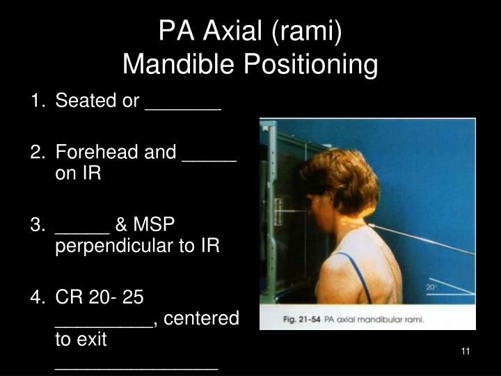 PPT - Week 7 :Mandible Week 8 : TMJ PowerPoint Presentation - ID:248399