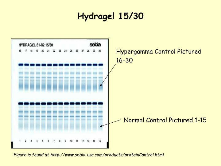 PPT - Practical training A1 Serum protein electrophoresis Pavla ...