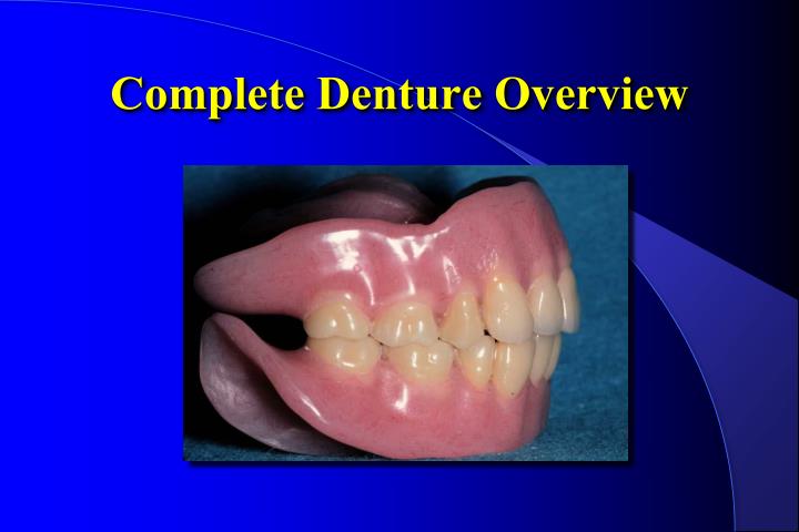 PPT - Complete Denture Overview PowerPoint Presentation, free download ...