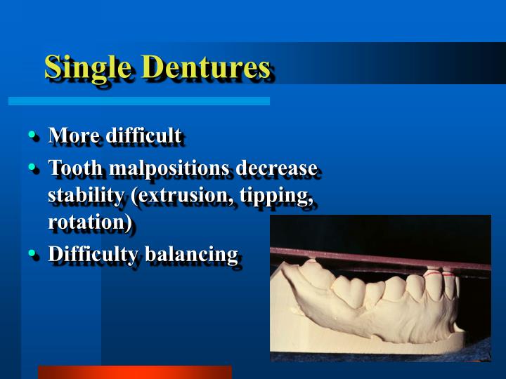 PPT - Single Complete Dentures PowerPoint Presentation - ID:248925