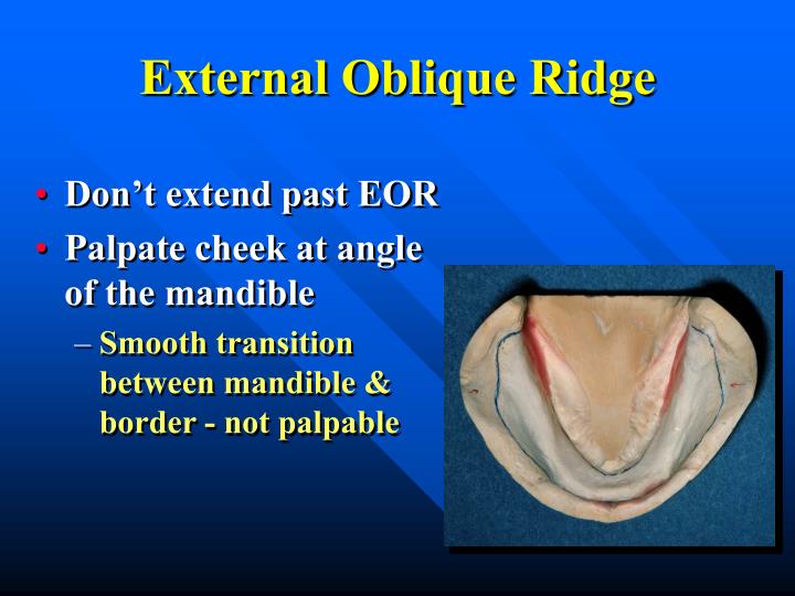 PPT - Border Molding PowerPoint Presentation - ID:249794