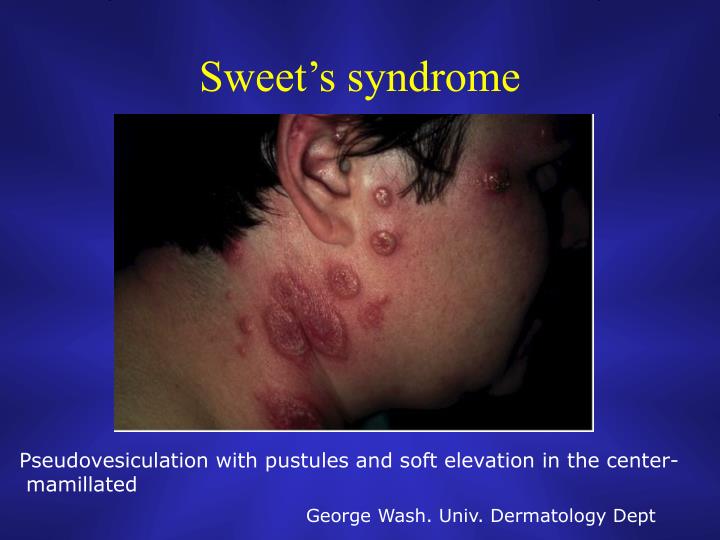PPT - Case Presentation-Dermatology PowerPoint Presentation - ID:249845