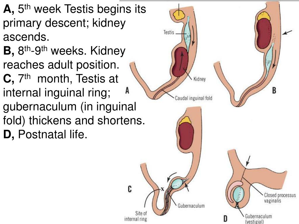 Ppt Undescended Testis Powerpoint Presentation Free Download Id 250379