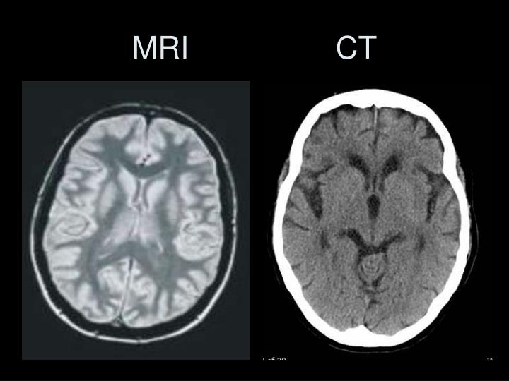 PPT - Image Quality PowerPoint Presentation - ID:251990