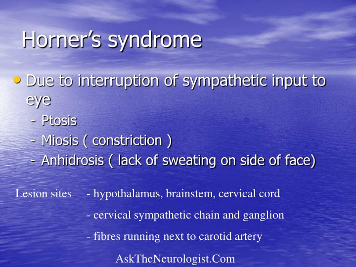 PPT - BRAIN STEM, CEREBELLUM and NEURO-OPTHALMOLOGY PowerPoint ...