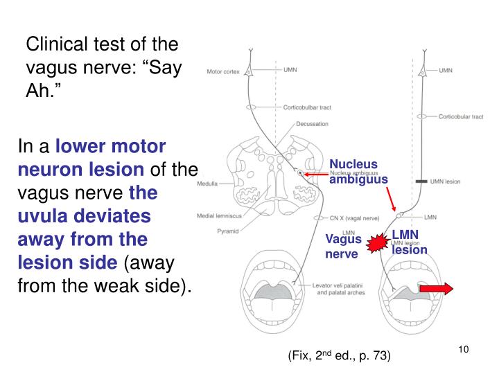 PPT - Review of Cranial and Spinal Nerves PowerPoint Presentation - ID ...