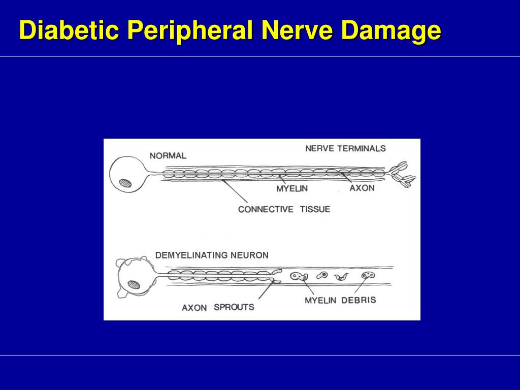 PPT - Duloxetine in the Treatment of Diabetic Peripheral Neuropathic ...