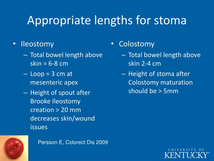 PPT - The Difficult Stoma PowerPoint Presentation - ID:257323