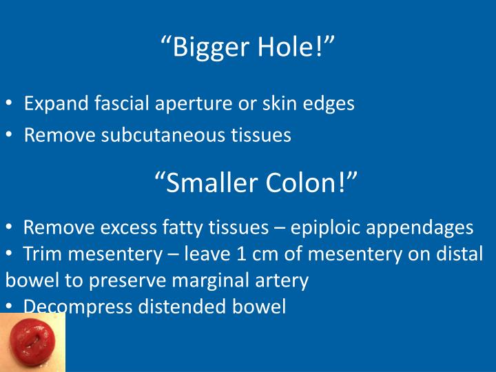 PPT - The Difficult Stoma PowerPoint Presentation - ID:257323