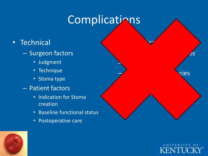 PPT - The Difficult Stoma PowerPoint Presentation - ID:257323
