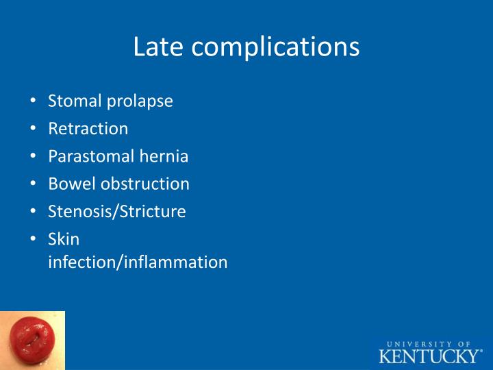 PPT - The Difficult Stoma PowerPoint Presentation - ID:257323