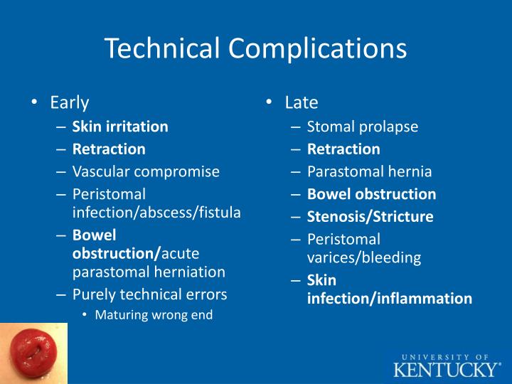 PPT - The Difficult Stoma PowerPoint Presentation - ID:257323