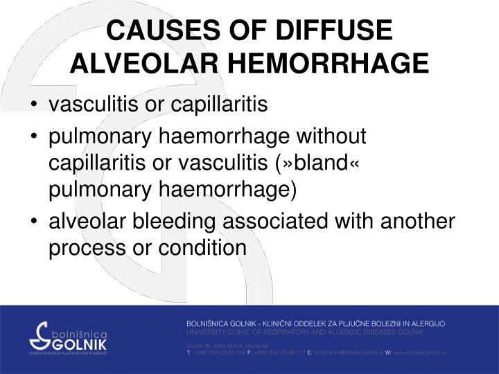 PPT - DIFFUSE ALVEOLAR HEMORRHAGE SYNDROM PowerPoint Presentation - ID ...