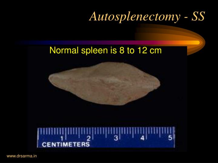 PPT - A Practical Approach to Anemia PowerPoint Presentation - ID:259255