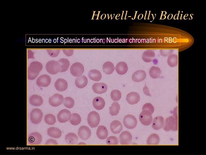 PPT - A Practical Approach to Anemia PowerPoint Presentation - ID:259255