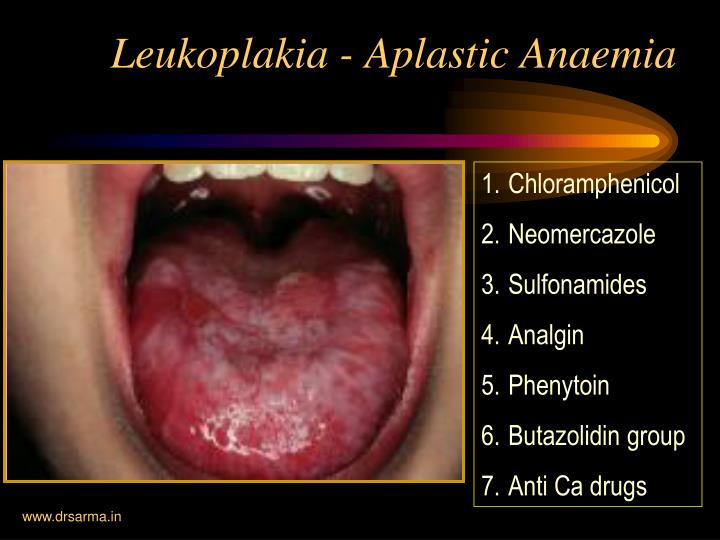 PPT - A Practical Approach to Anemia PowerPoint Presentation - ID:259255