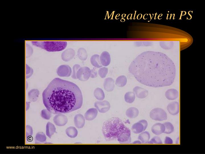 PPT - A Practical Approach to Anemia PowerPoint Presentation - ID:259255