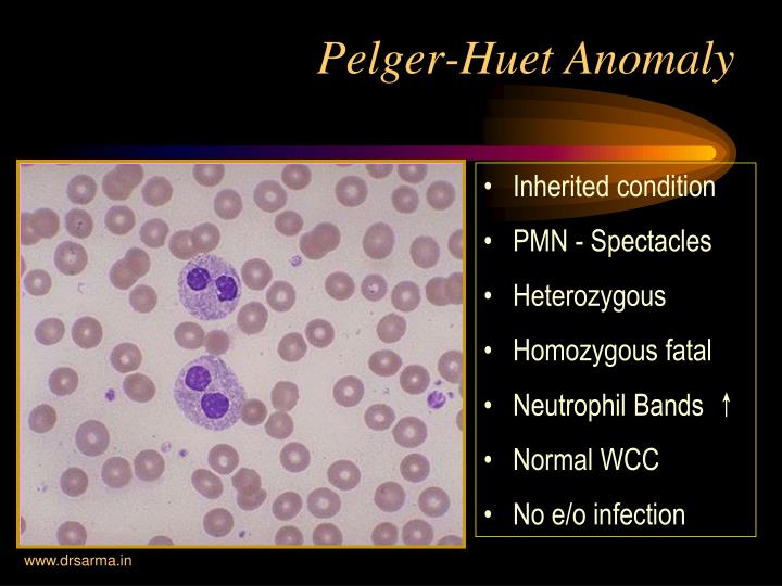 PPT - A Practical Approach to Anemia PowerPoint Presentation - ID:259255