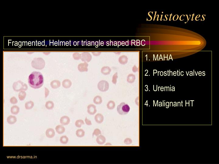 PPT - A Practical Approach to Anemia PowerPoint Presentation - ID:259255