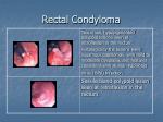 PPT - Colonic polyps By assistant lecturer: Waleed Fouad PowerPoint ...