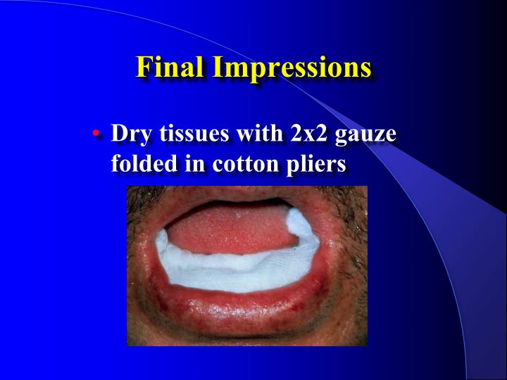 PPT - Final Impressions for Complete Dentures PowerPoint Presentation ...