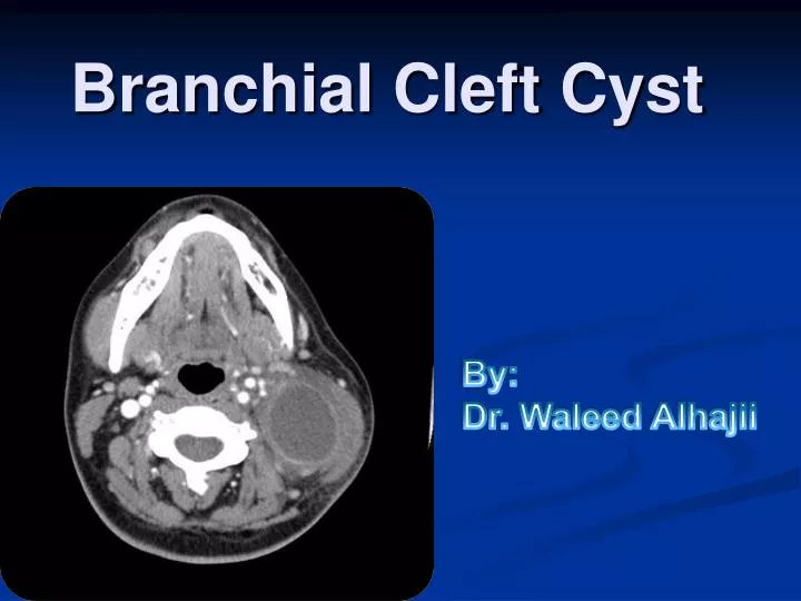 PPT - Branchial Cleft Cyst PowerPoint Presentation, free download - ID ...