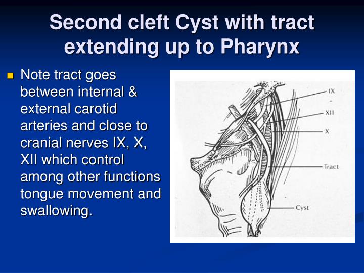 Ppt Branchial Cleft Cyst Powerpoint Presentation Id261469