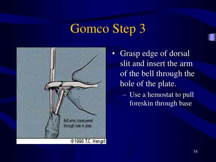 PPT - Neonatal Circumcision PowerPoint Presentation - ID:262163