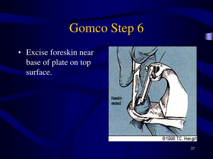 PPT - Neonatal Circumcision PowerPoint Presentation - ID:262163